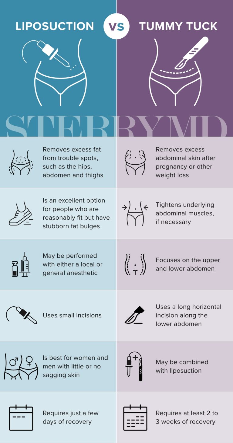 Tummy Tuck vs Liposuction: Which Is Right for You? – Thomas P. Sterry, MD