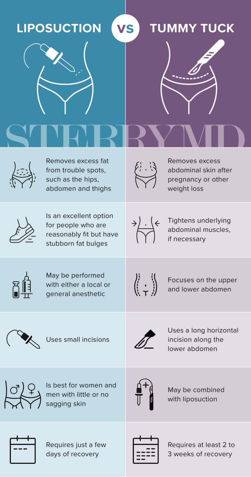 Tummy Tuck vs Liposuction: Which Is Right for You? – Thomas P. Sterry, MD